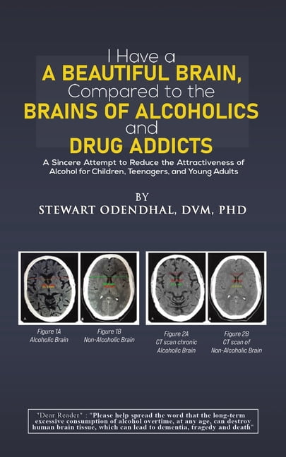 I Have a Beautiful Brain, Compared to the Brains of Alcoholics and Drug ...