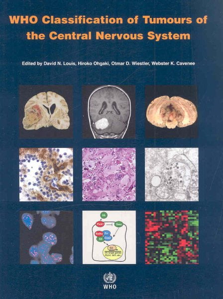 IARC Who Classification of Tumours: Who Classification of Tumours of the Central Nervous System ...