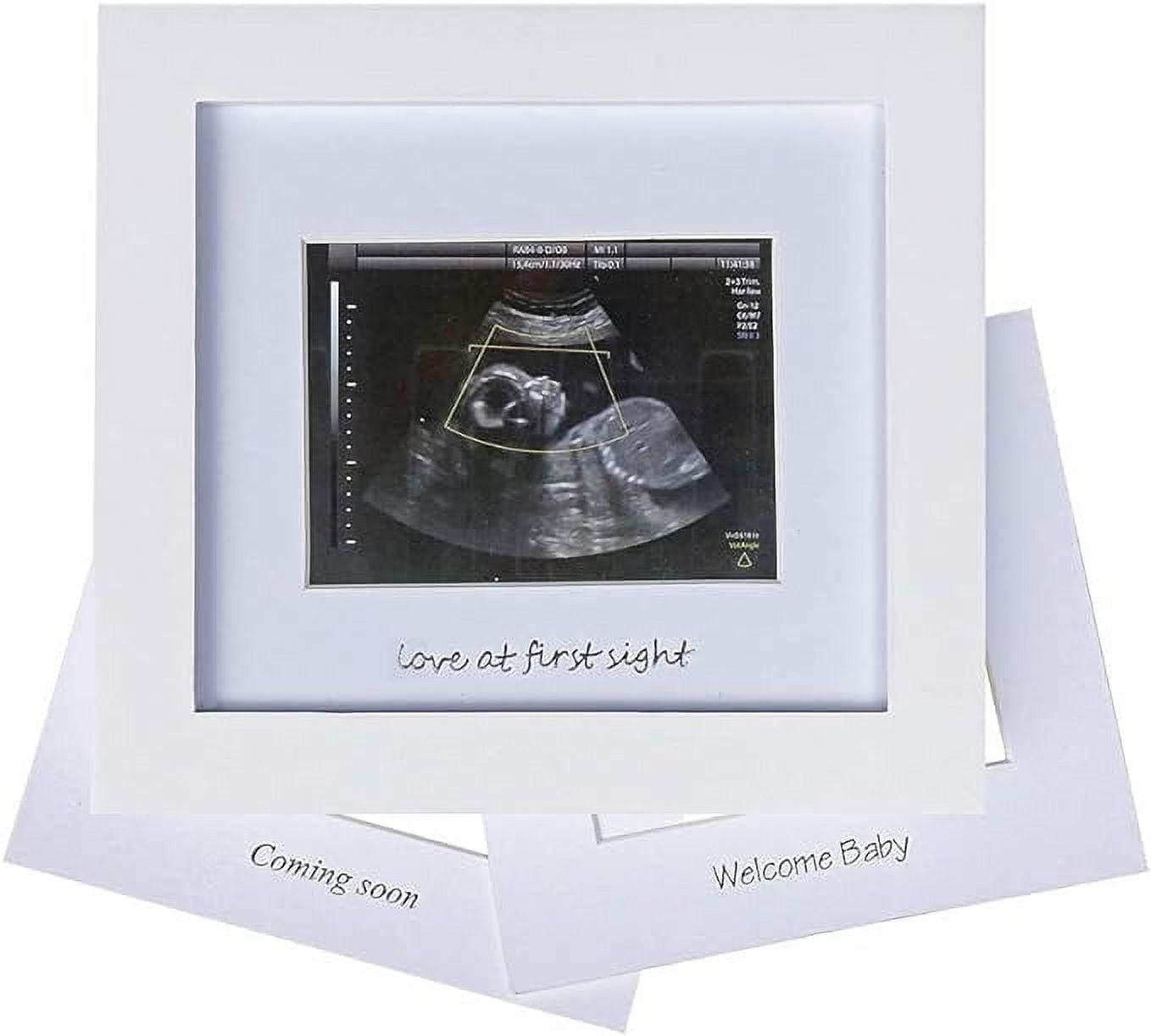 IHEIPYE Baby Sonogram Photo Frame - 1st Ultrasound Picture Frame - Idea ...