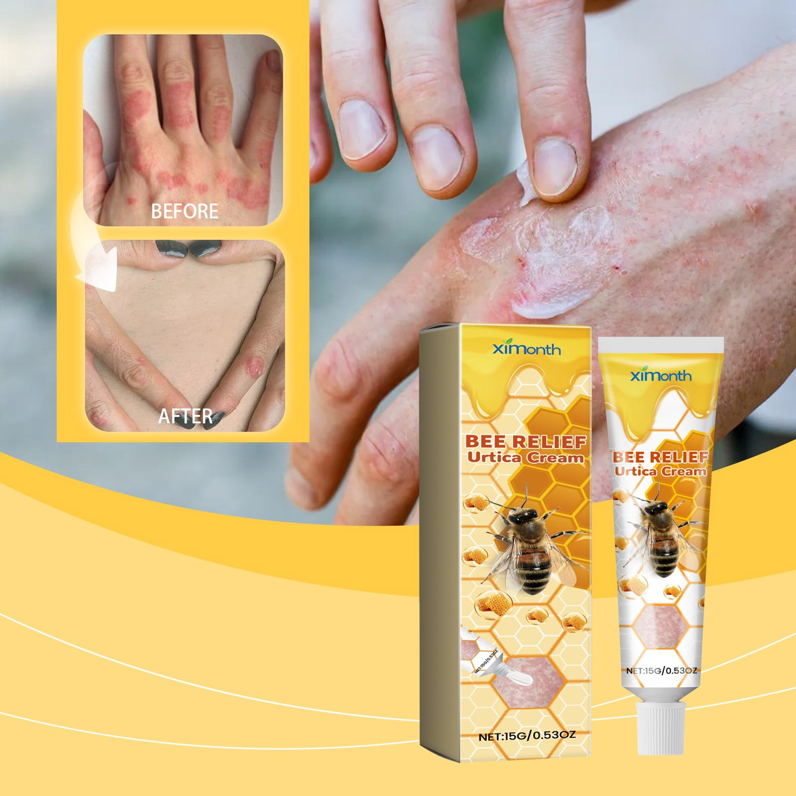 IegmanFragrance,Wart Ointment Smooth Skin Fade Mole Spotting Wart ...