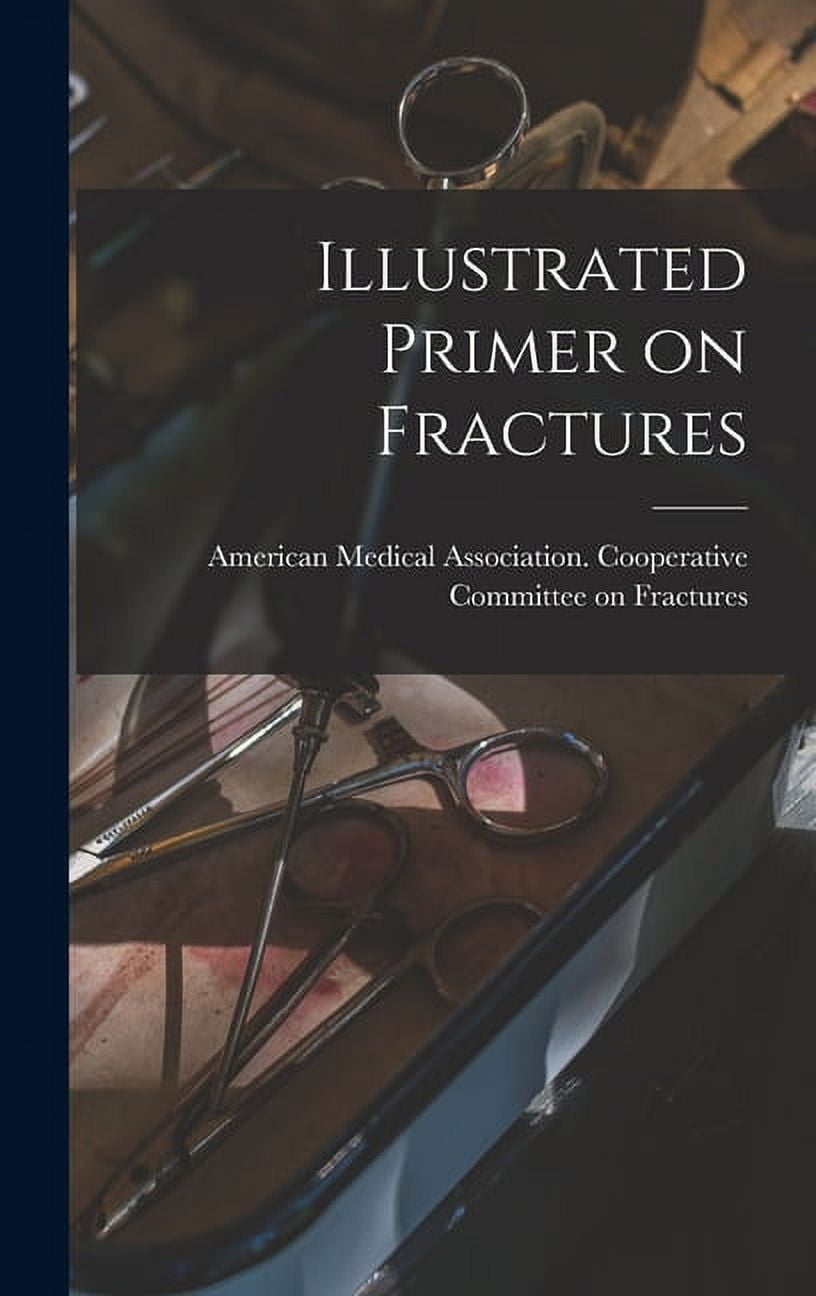 Illustrated Primer on Fractures, (Hardcover) - Walmart.com