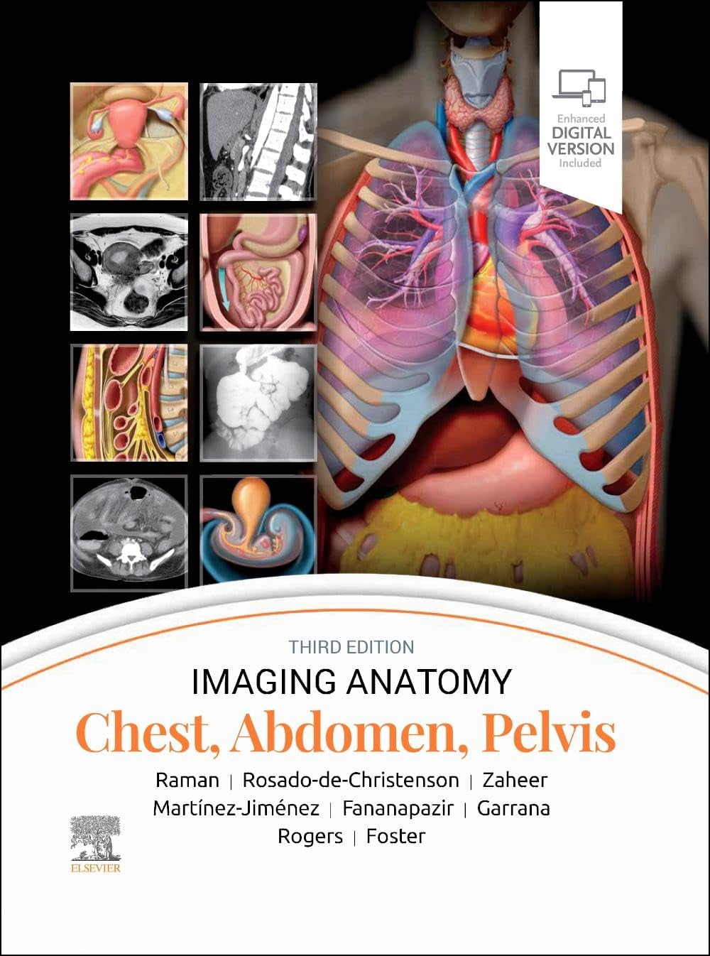 Pre-Owned Imaging Anatomy: Chest, Abdomen, Pelvis [Hardcover] Raman MD ...