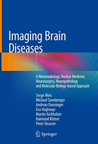 Pre-Owned Imaging Brain Diseases: A Neuroradiology, Nuclear Medicine, Neurosurgery ...