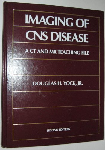 Pre-Owned Imaging of CNS Disease: A CT and MRI Teaching File: Current ...