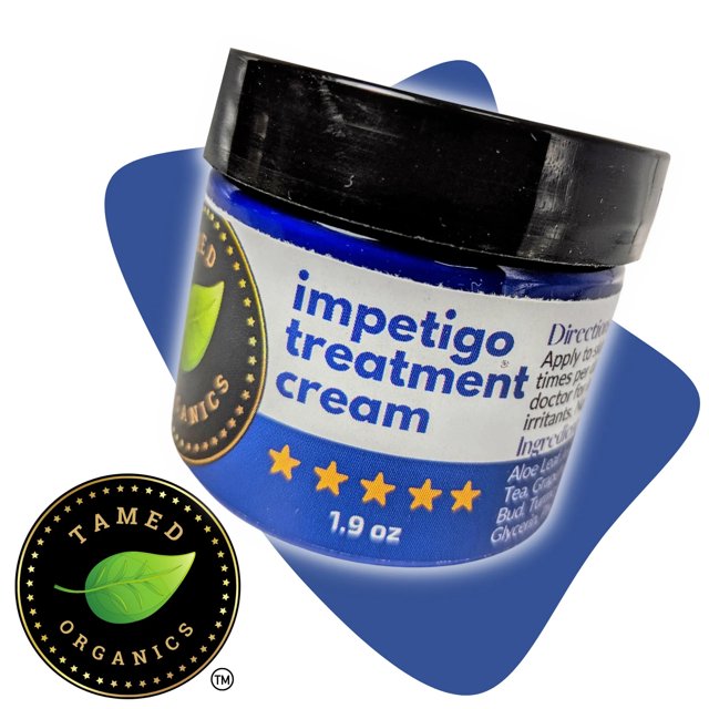 Impetigo Topical Relief Treatment Cream Over The Counter by Tamed ...