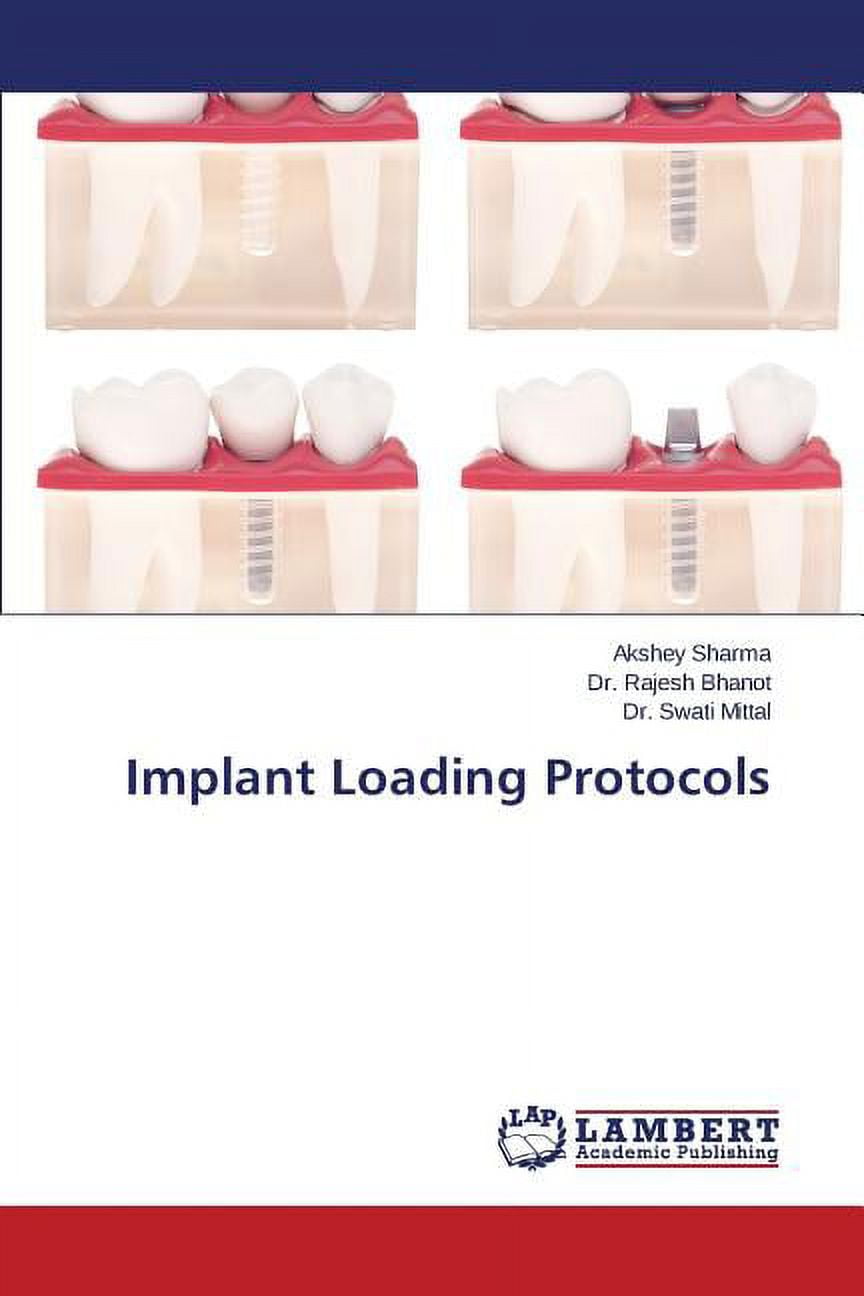 Implant Loading Protocols (Paperback) - Walmart.com