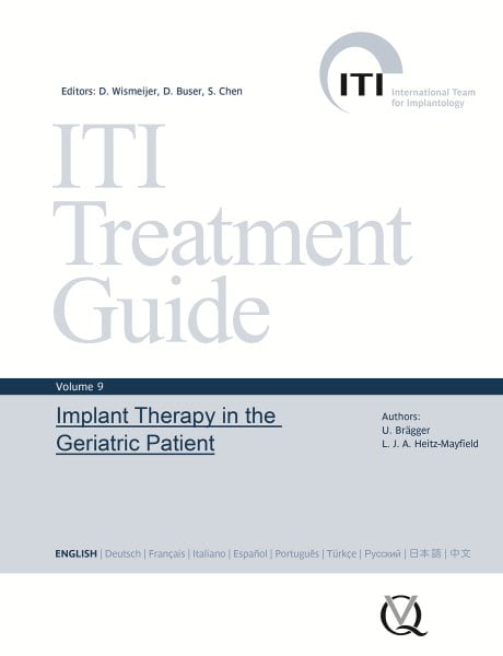 Implant Therapy in the Geriatric Patient - Walmart.com
