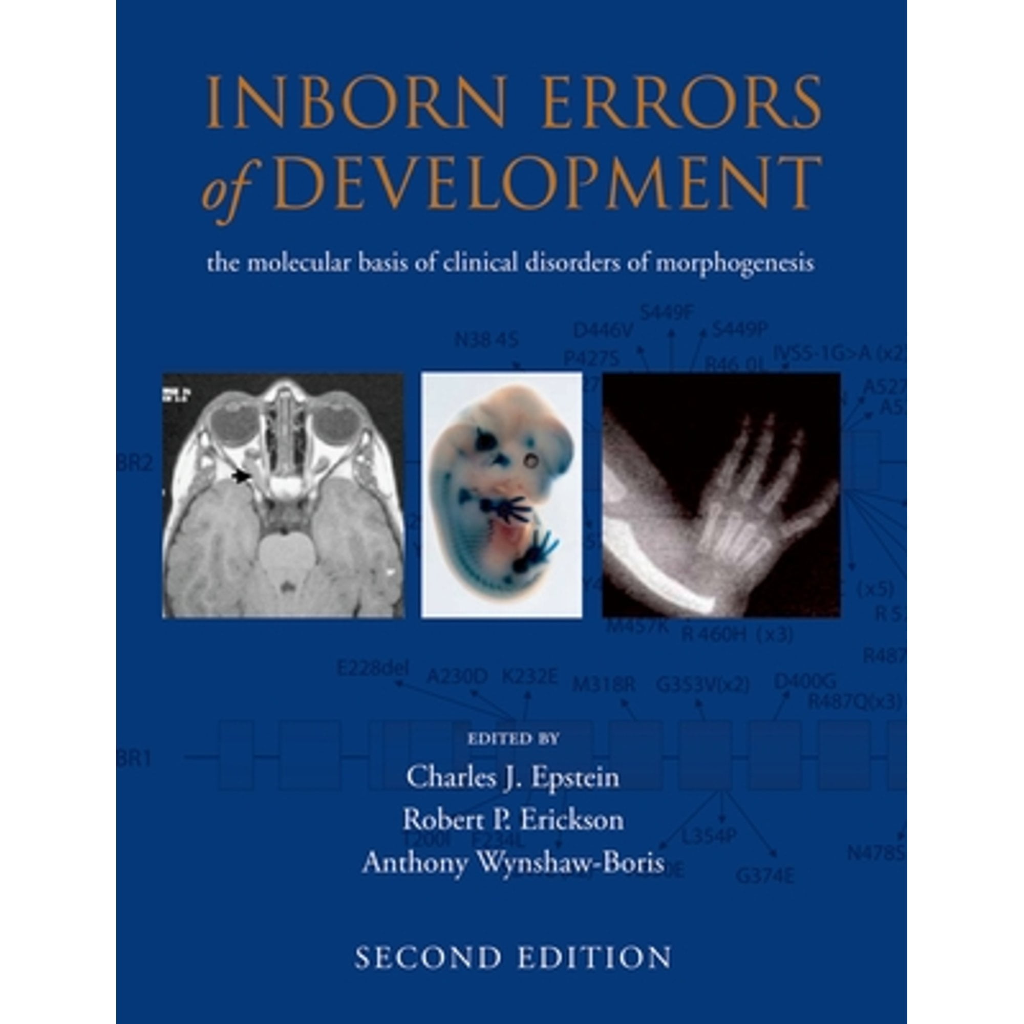Pre-Owned Inborn Errors of Development (Oxford Monographs on Medical ...