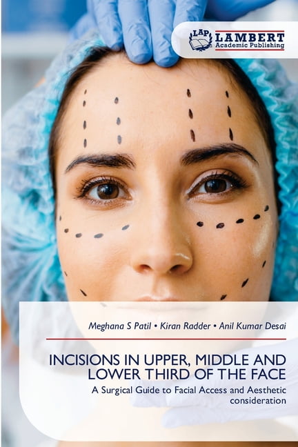 Incisions in Upper, Middle and Lower Third of the Face, (Paperback ...