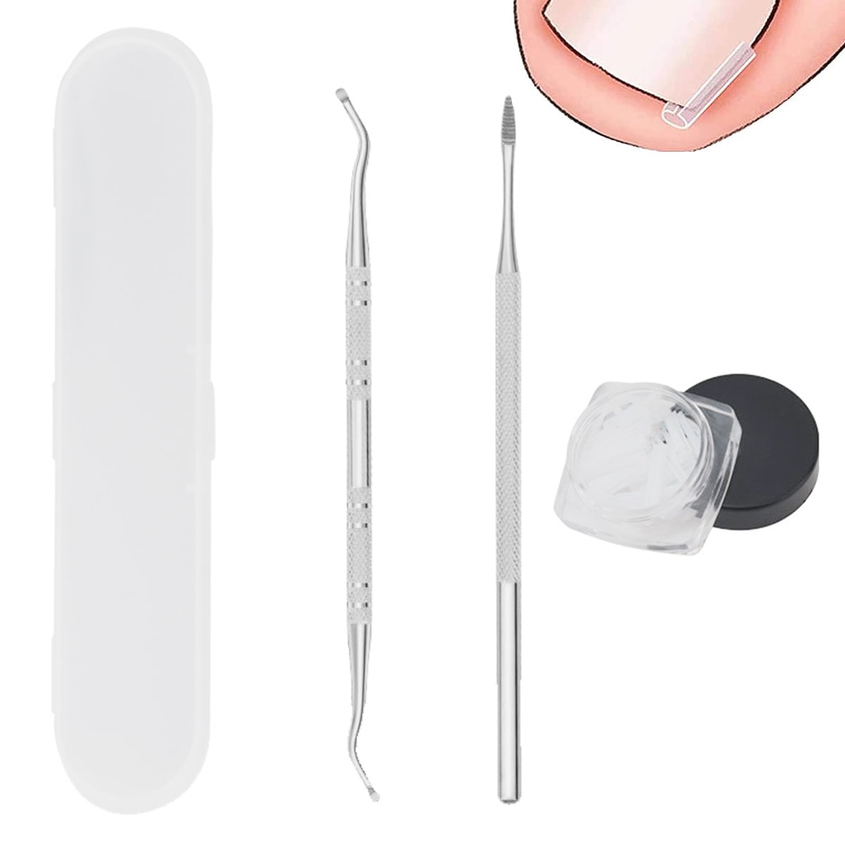Ingrown Toenail Correction Treatment Kit, 50 Pcs Ingrown Toenail ...