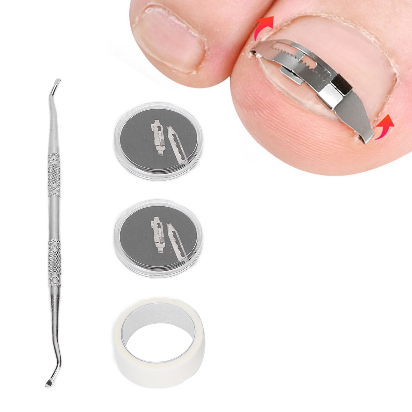 Ingrown Toenail Corrector, High Strength Toenail Straightening Tool For ...