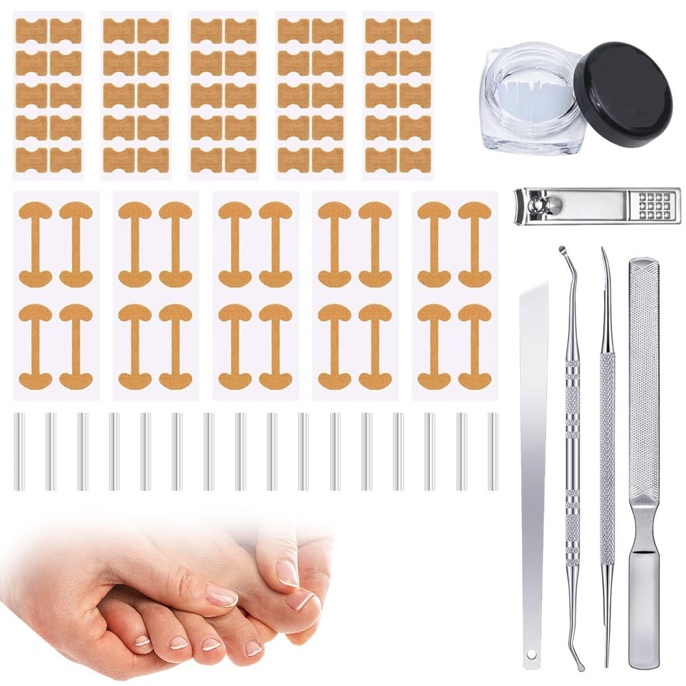 Ingrown Toenail Corrector Set with Correction Strips, Toenail Lifter ...