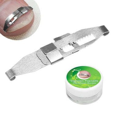 OTVIAP Ingrown Toenail Fixer Adjustable Toe Nail Paronychia Corrector ...