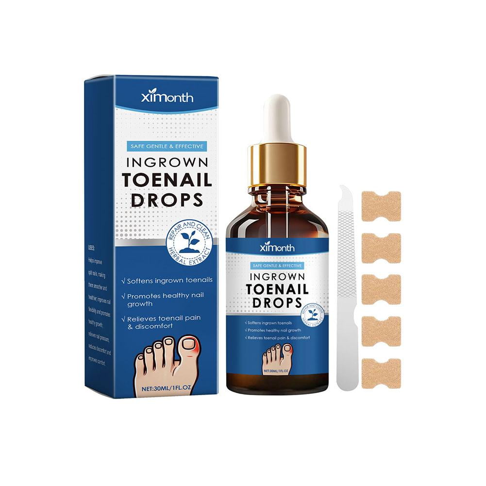 Ingrown Toenail Pain Reliever, Medicated Gel Softens Nails for Easy ...