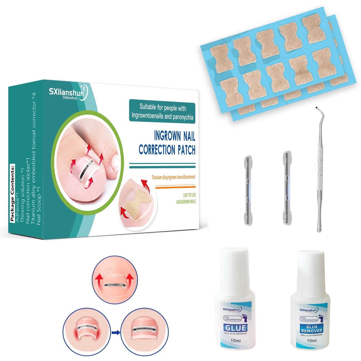 Ingrown Toenail Removal Kit Professional Tools for Ingrown Toenail ...