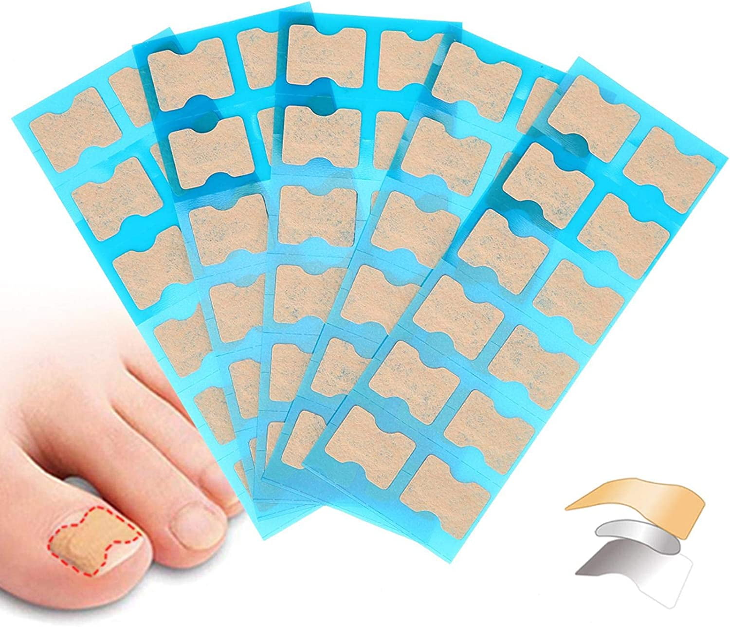 Ingrown Toenail Sticker, Ingrown Toenail Patch Ingrown Toenail ...
