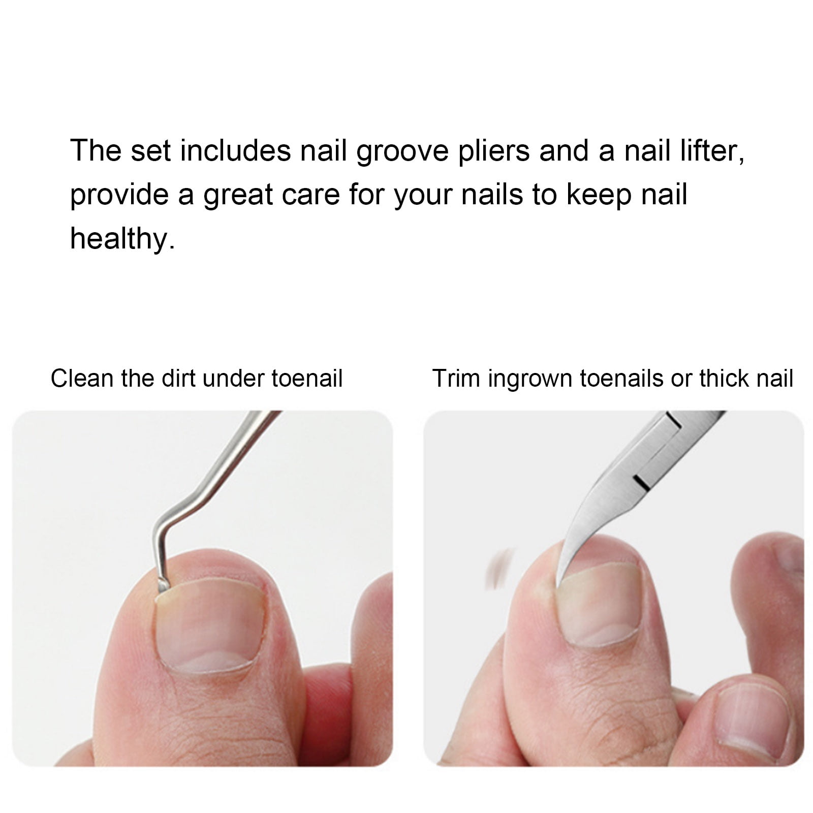Ingrown Toenail Tools Kit, Lifter Toenail Pliers Nails Stainless Steel ...