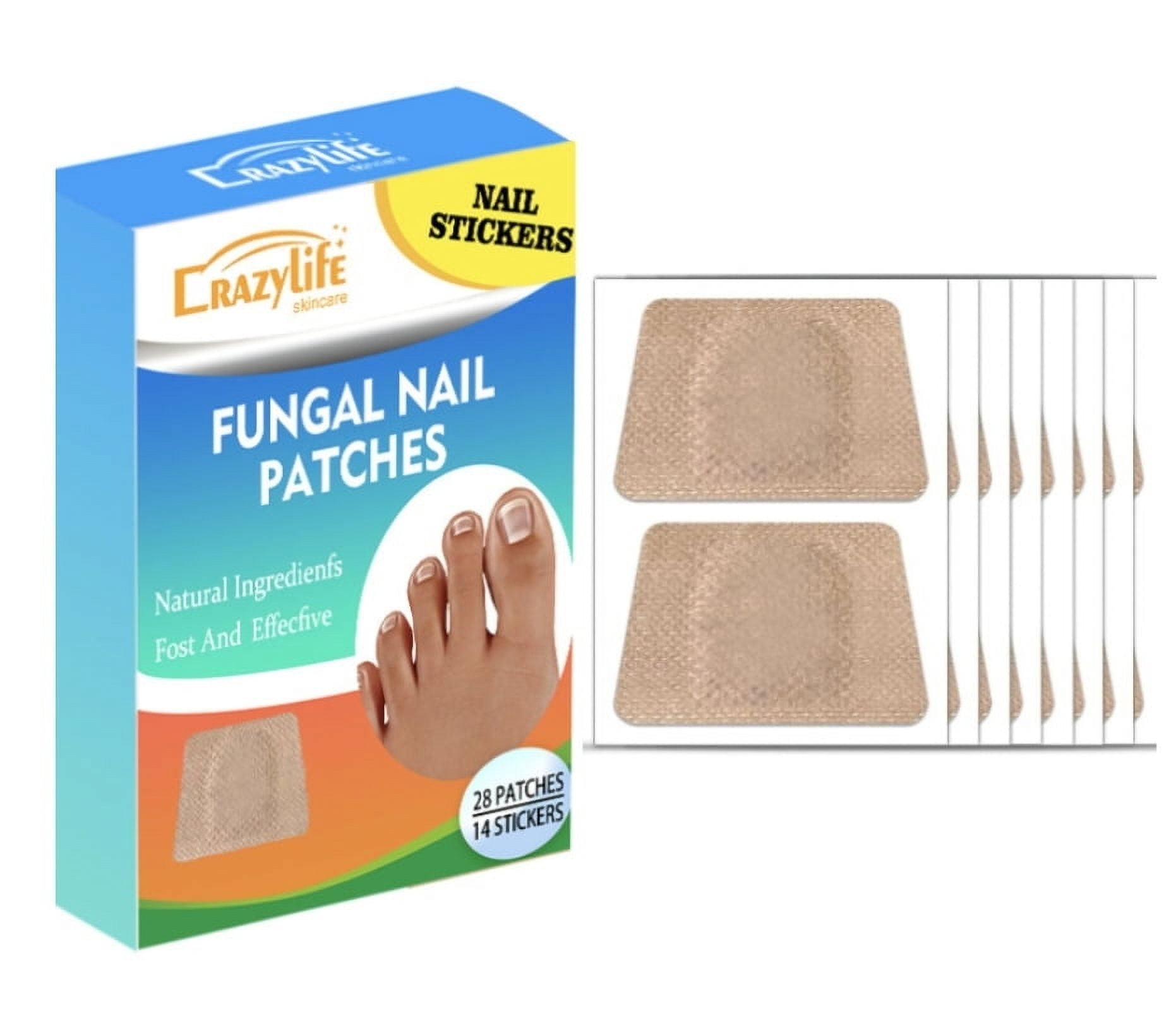 Ingrown Toenail Treatment, 14 Pcs No Glue Ingrown Toenail Corrector ...