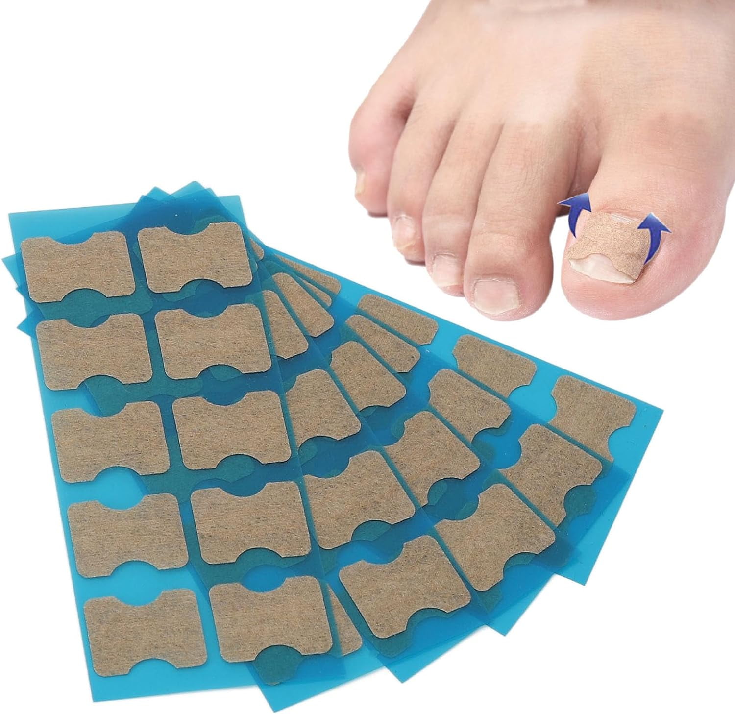 Ingrown Toenail Treatment, 50Pcs Ingrown Toenail Corrector Strips, Glue ...