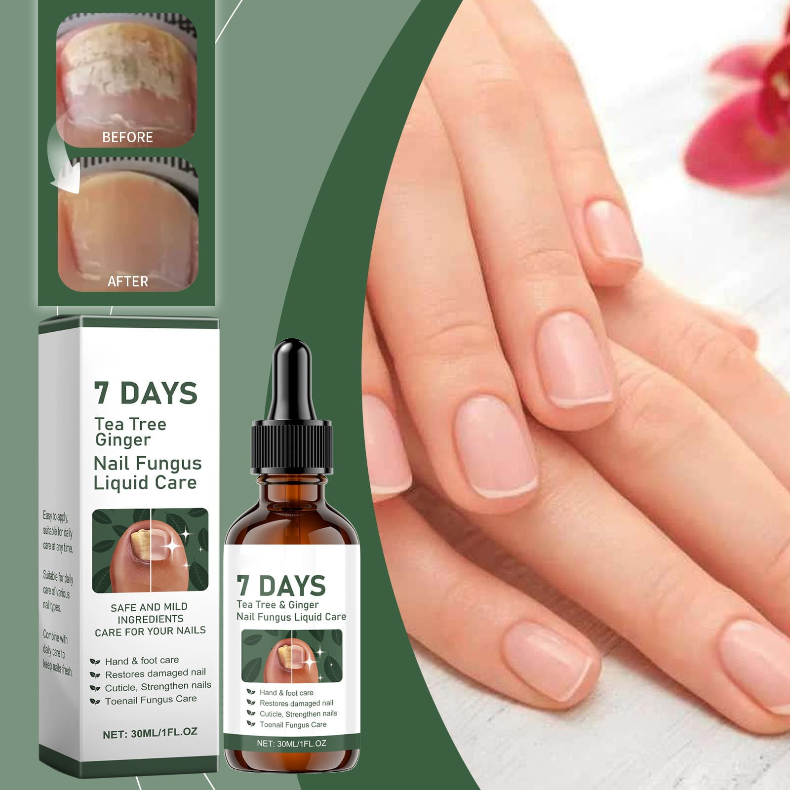 Ingrown Toenail Treatment: Ingrown Toenail Removal Kit - Nail Toe ...