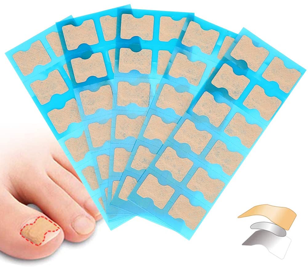 Ingrown Toenail Treatment, Nail Patch, Ingrown Toenail Corrector ...