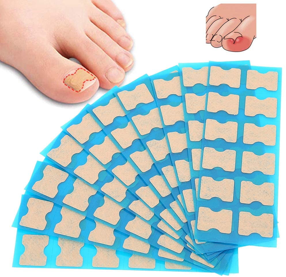 Ingrown Toenail Treatment, Nail Patch, Ingrown Toenail Corrector ...