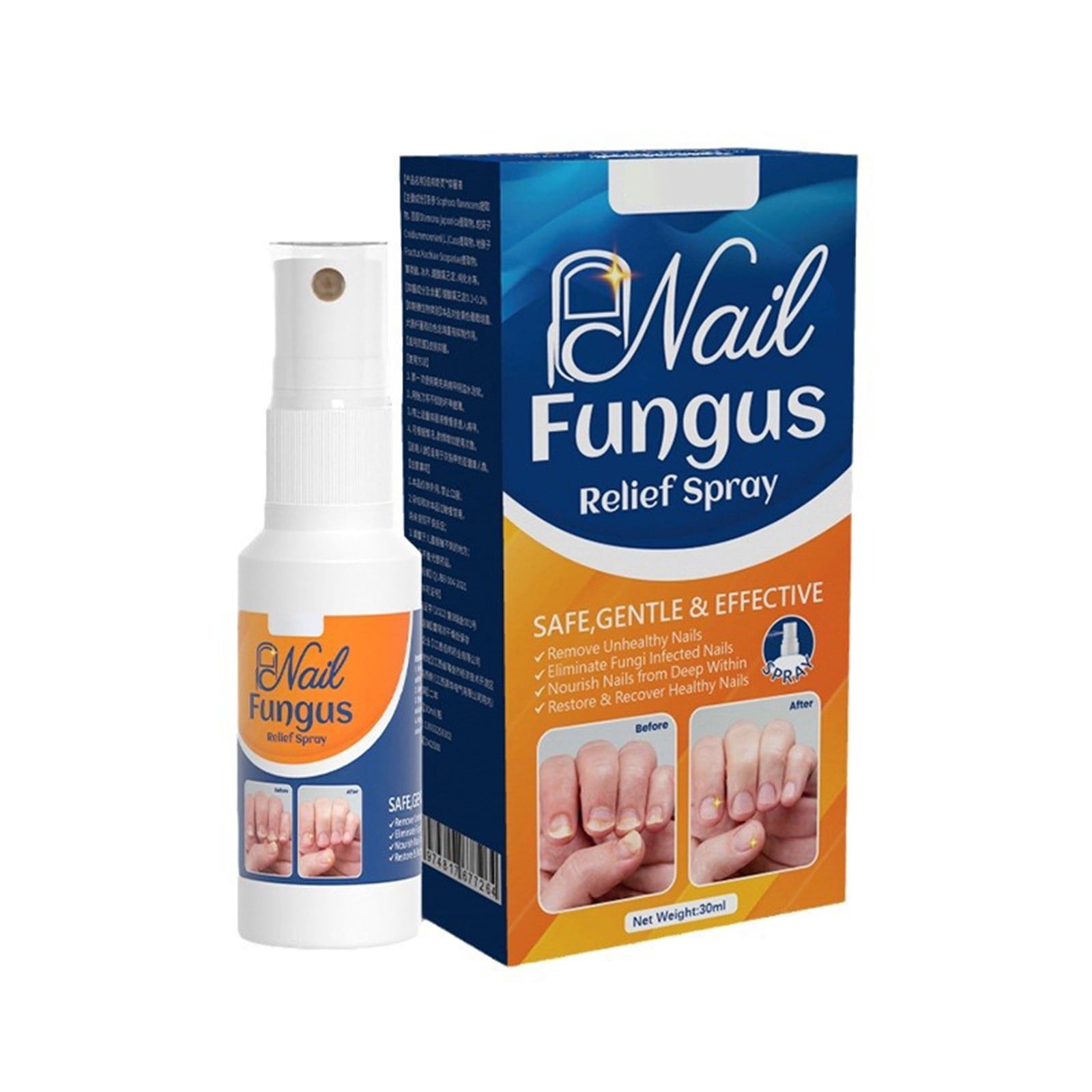 Ingrown Toenail Treatment Toenail Fungus Care,FastActing Nail Care ...