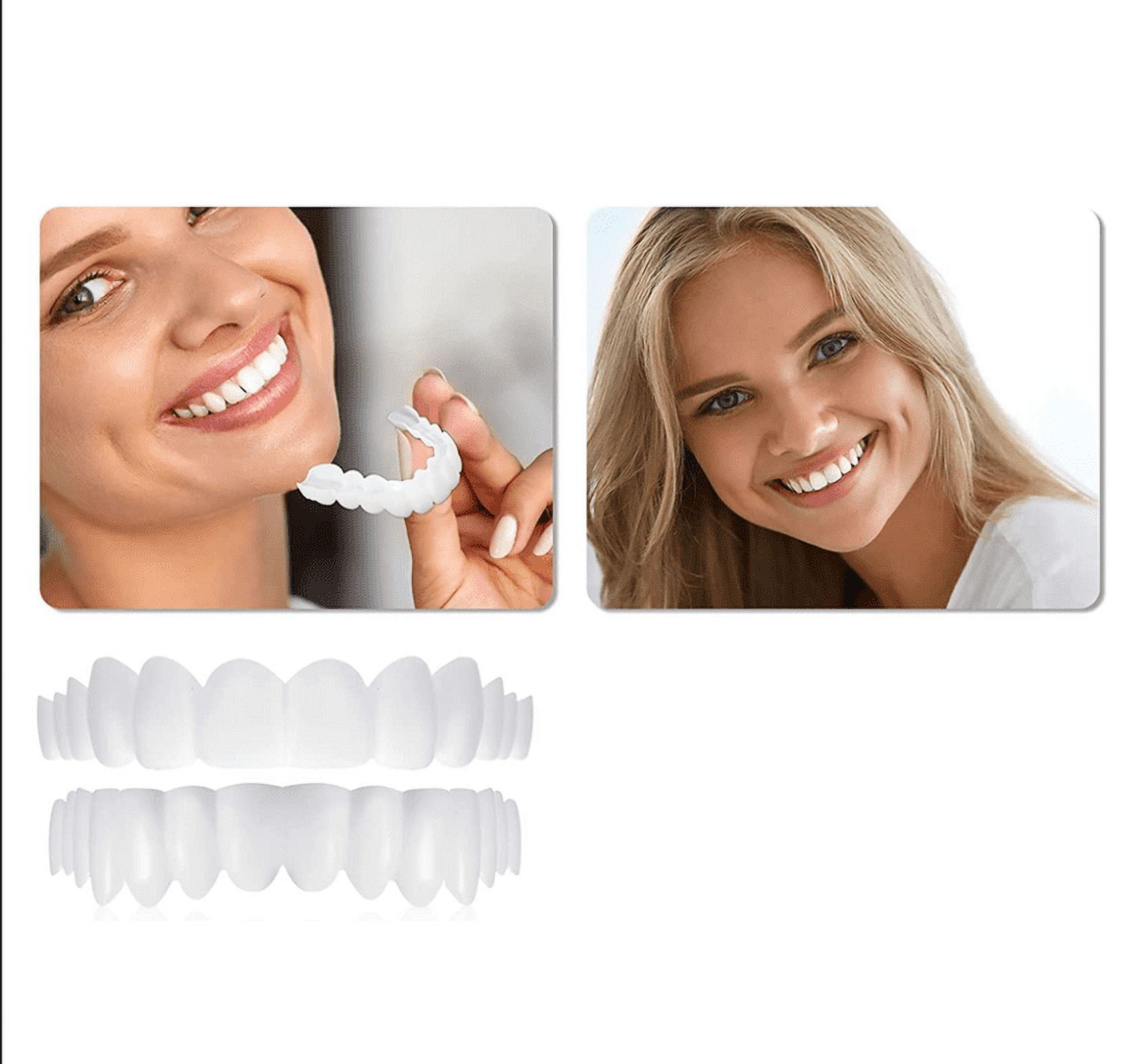 Instant Cosmetic Veneer Dentures Jagged Smile Top Bottom Straightening ...