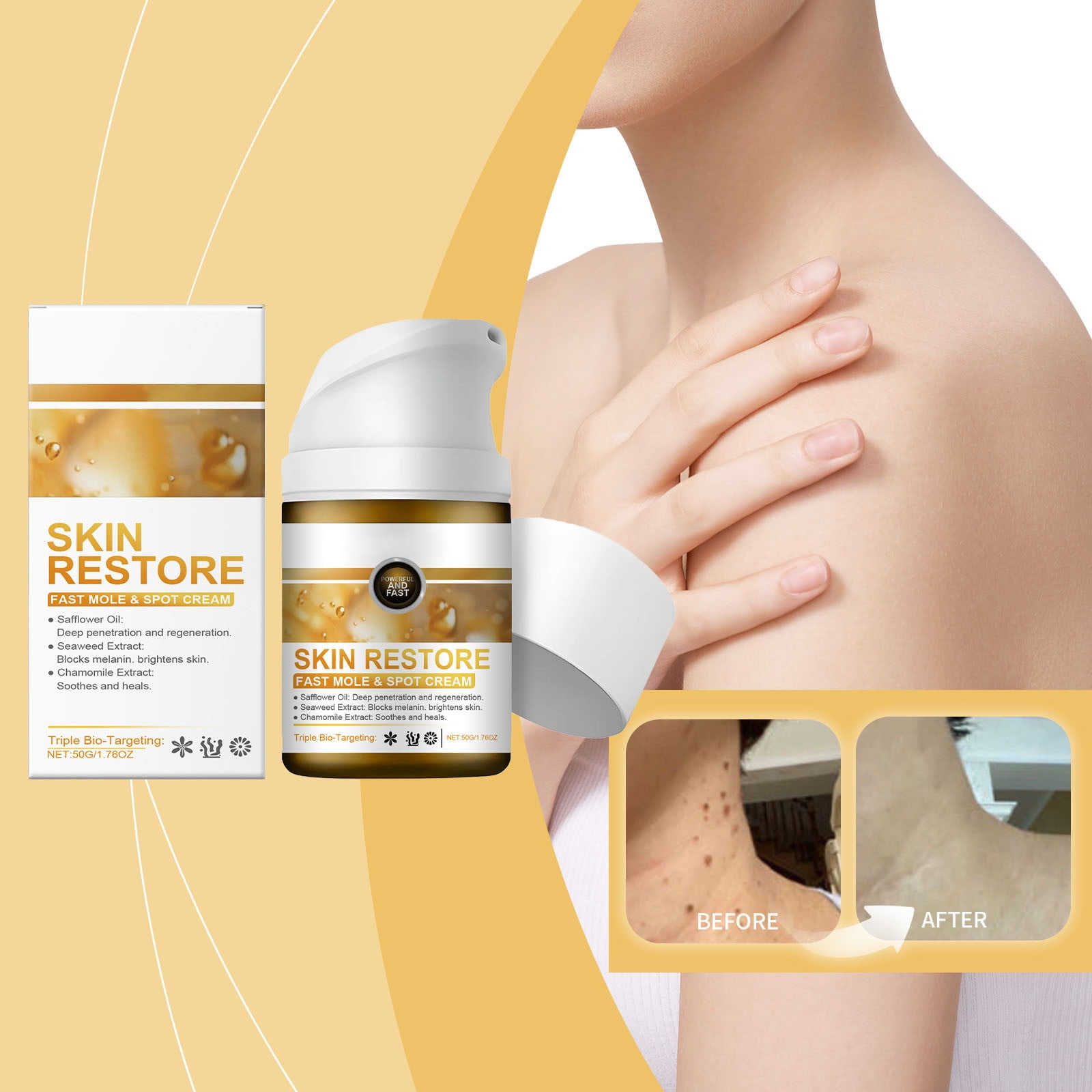 Instant Mole & Spot Cream Serum, All-Body Skin Texture Corrector ...