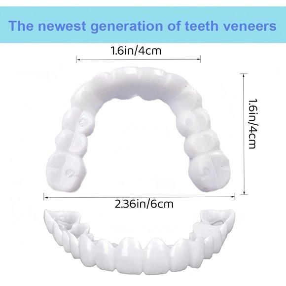 clip-on-veneers