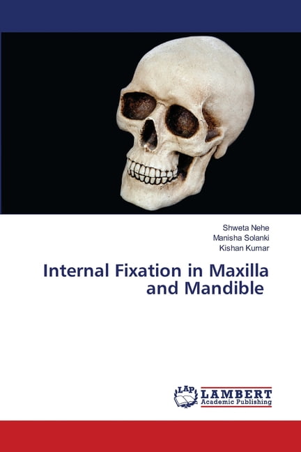 Internal Fixation in Maxilla and Mandible, (Paperback) - Walmart.com