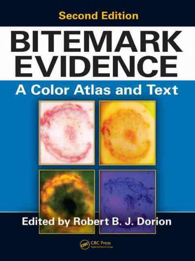 Pre-Owned International Forensic Science and Investigation: Bitemark ...