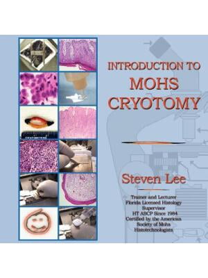 Introduction to MOHS Cryotomy - Walmart.com
