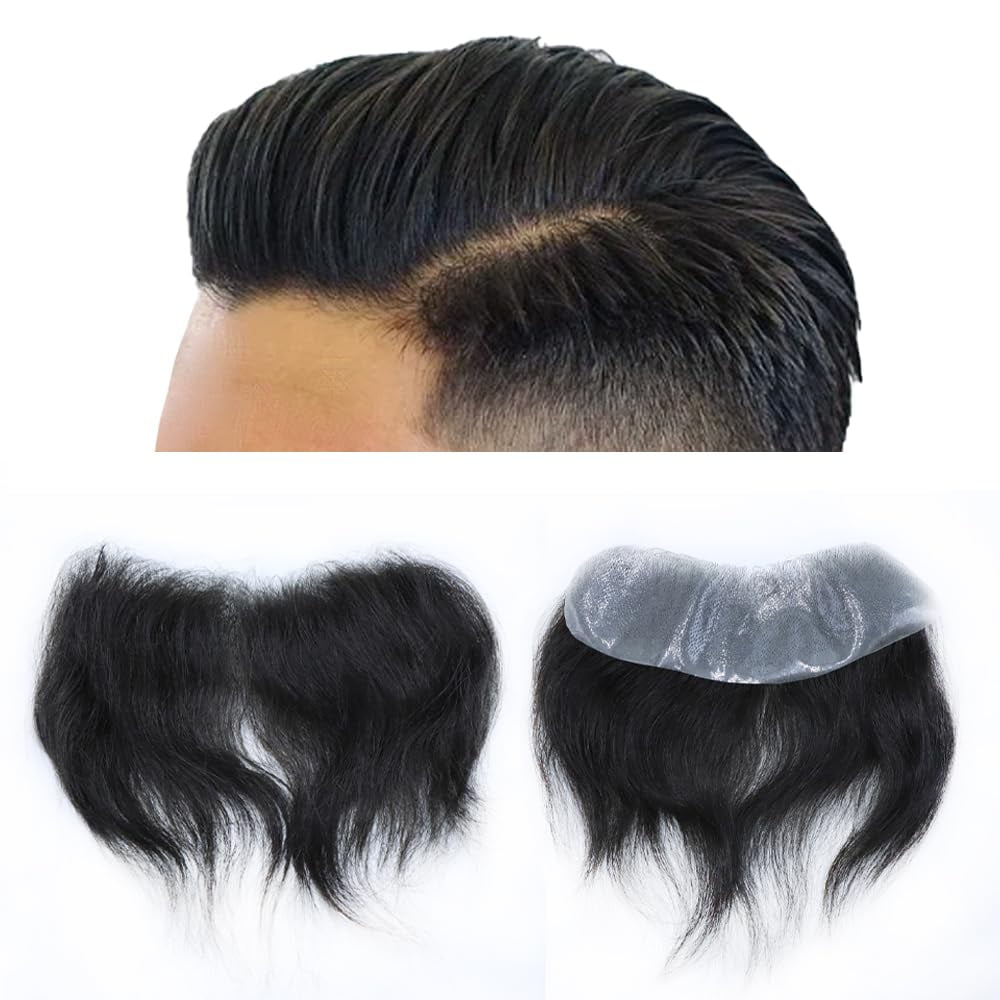 Invisible Mens Receding Hairline Human Hair Replacement System Mens ...