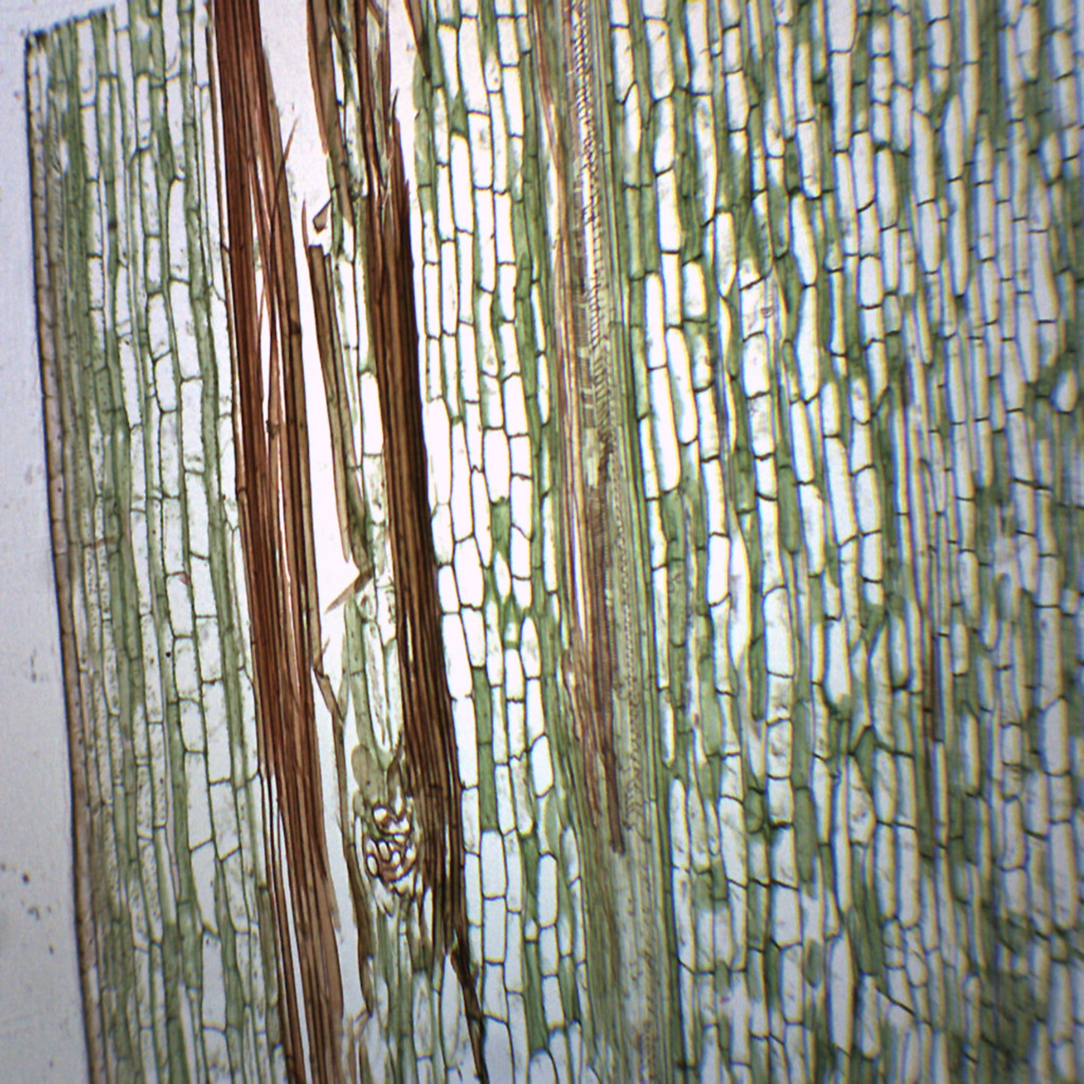 Iris Stem - Cross Section & Longitudinal Section - Prepared Microscope ...