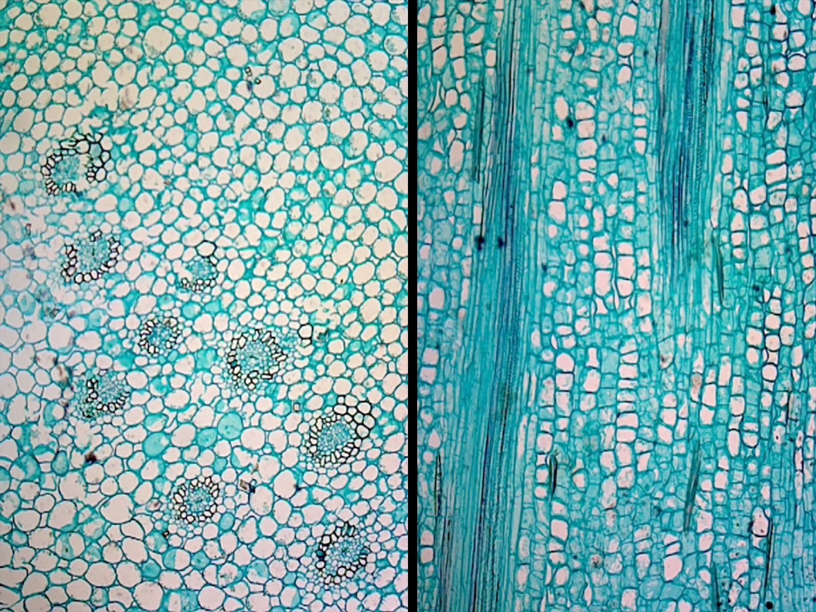Iris Stem; Typical Monocot Stem; Cross Section and Longitudinal Section ...