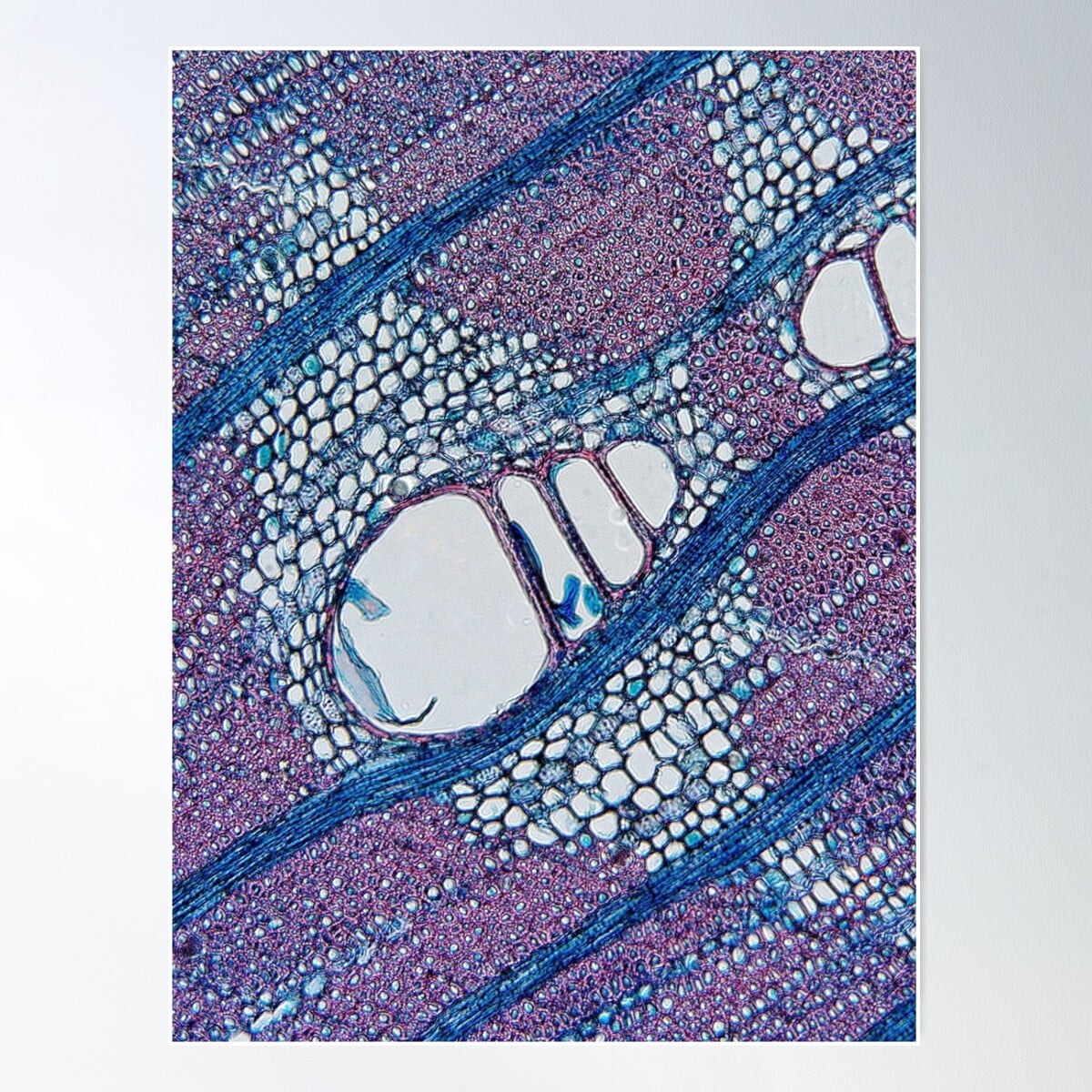 Iroko Tree, Wood Cells, Cross Section; Plant Anatomy, Microscopy Poster ...