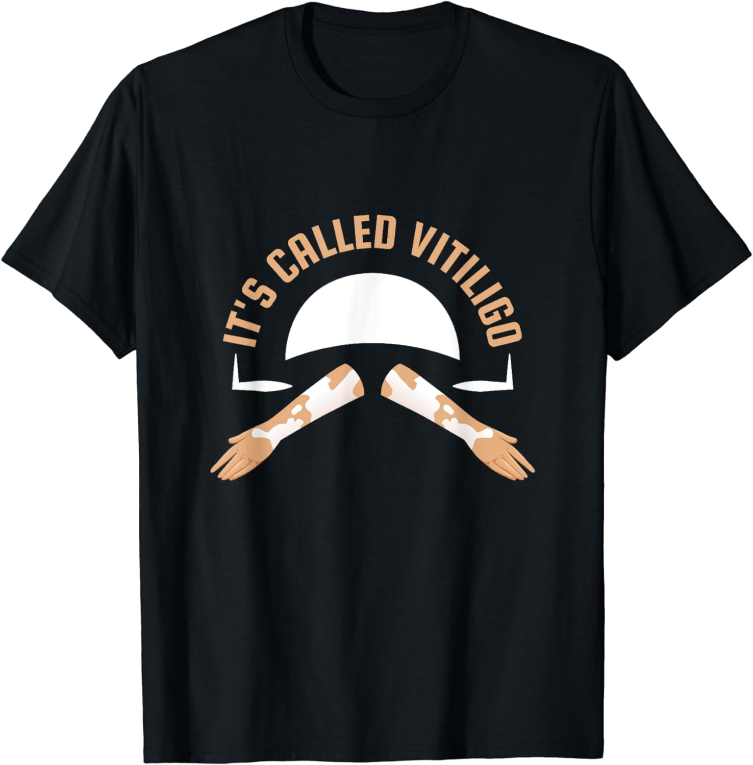 Its Called Vitiligo Proud Funny T About Vitiligo T Shirt