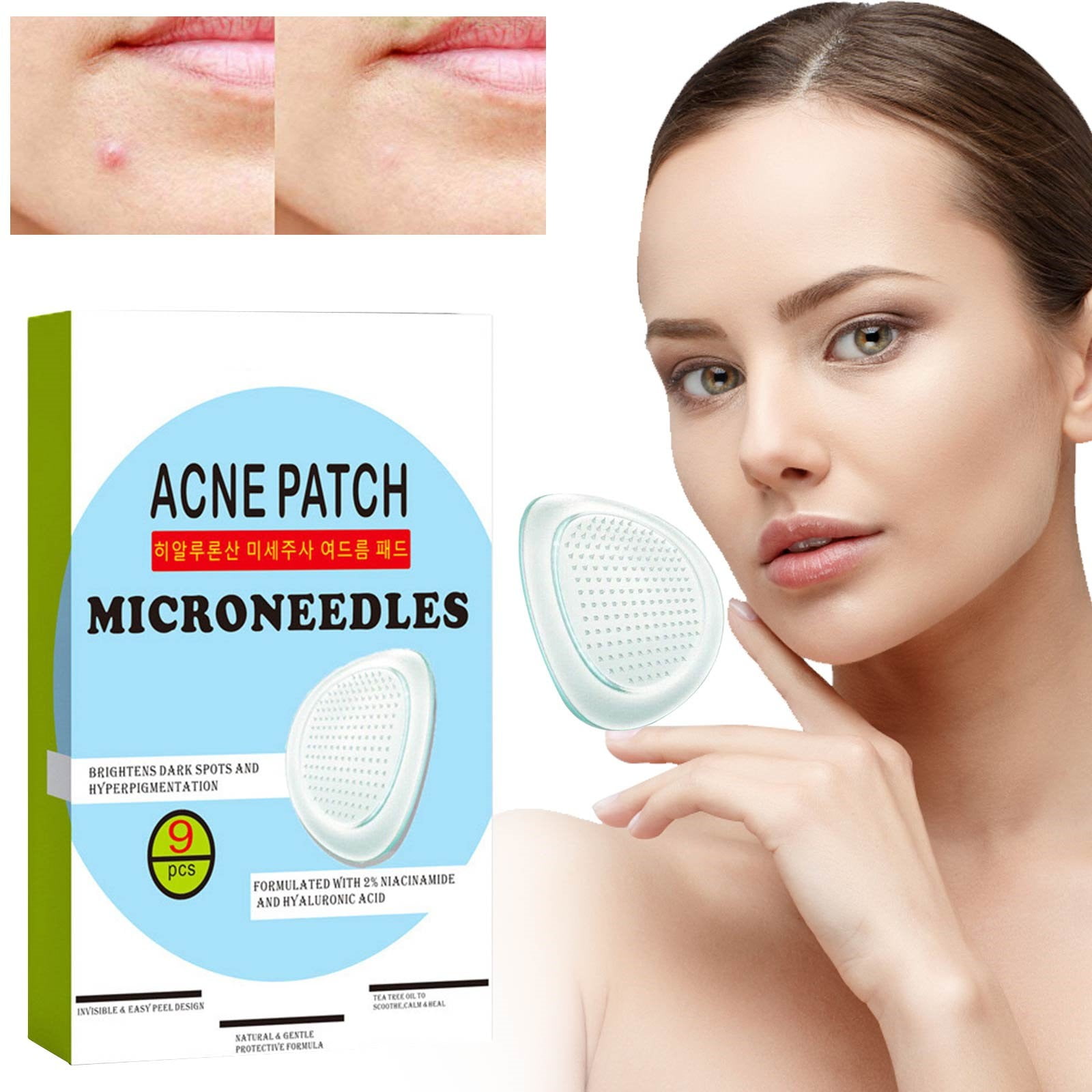 Microcrystal Patch Pimple Patch Face Removing Stickers Patchess ...