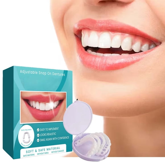 clip-on-veneers
