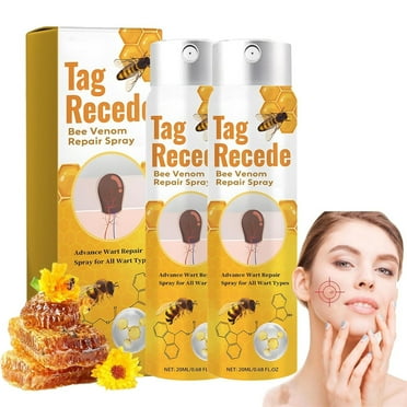 Chigg Away 4 fl oz Lotion for Itchy Skin and Bug Bite Relief - Walmart.com