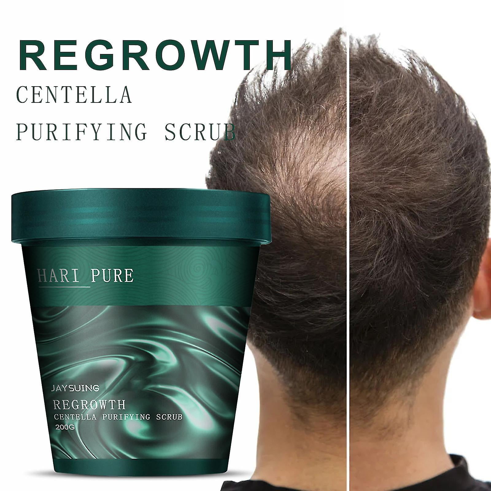 Jaysuing Centella Asiatica Scrub Hair Cleansing, Anti-Dandruff, Anti ...