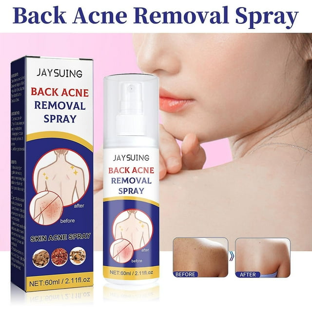 Jaysuing Back Care Spray Fades Back Acne Marks Smooths Skin And Cleanses The Skin Bf