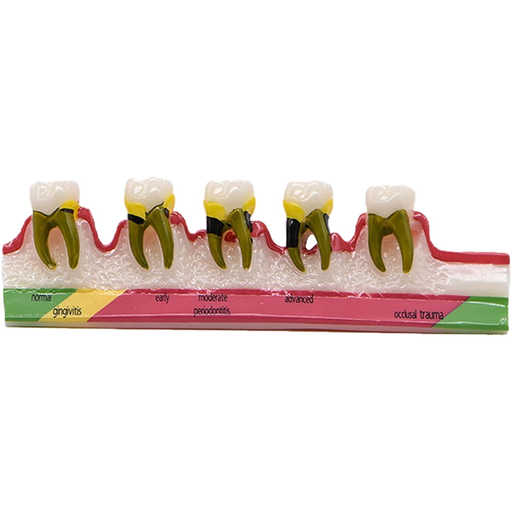 Jiibva Dental Demonstration Model, Teaching Aid for Tooth and ...