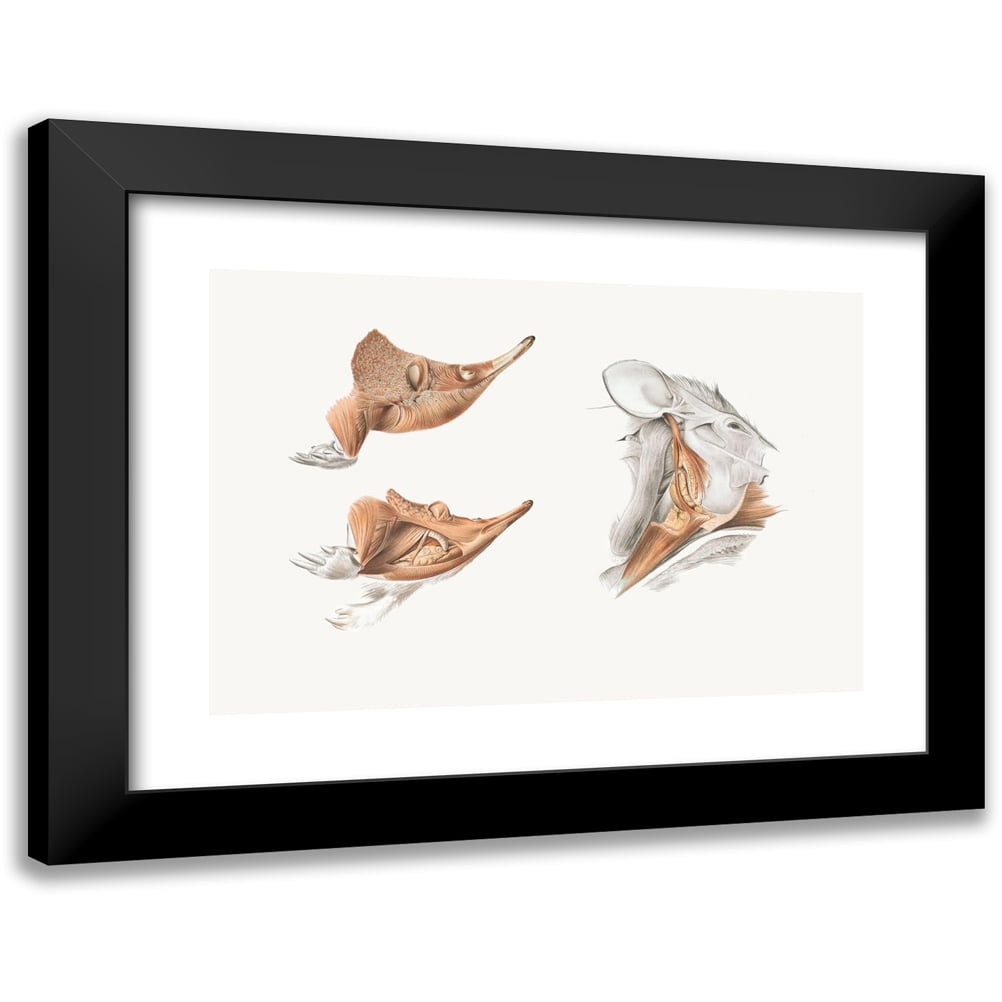 Johan Erik Vesti Boas 14x11 Black Modern Framed Museum Art Print Titled - Superficial Facial ...