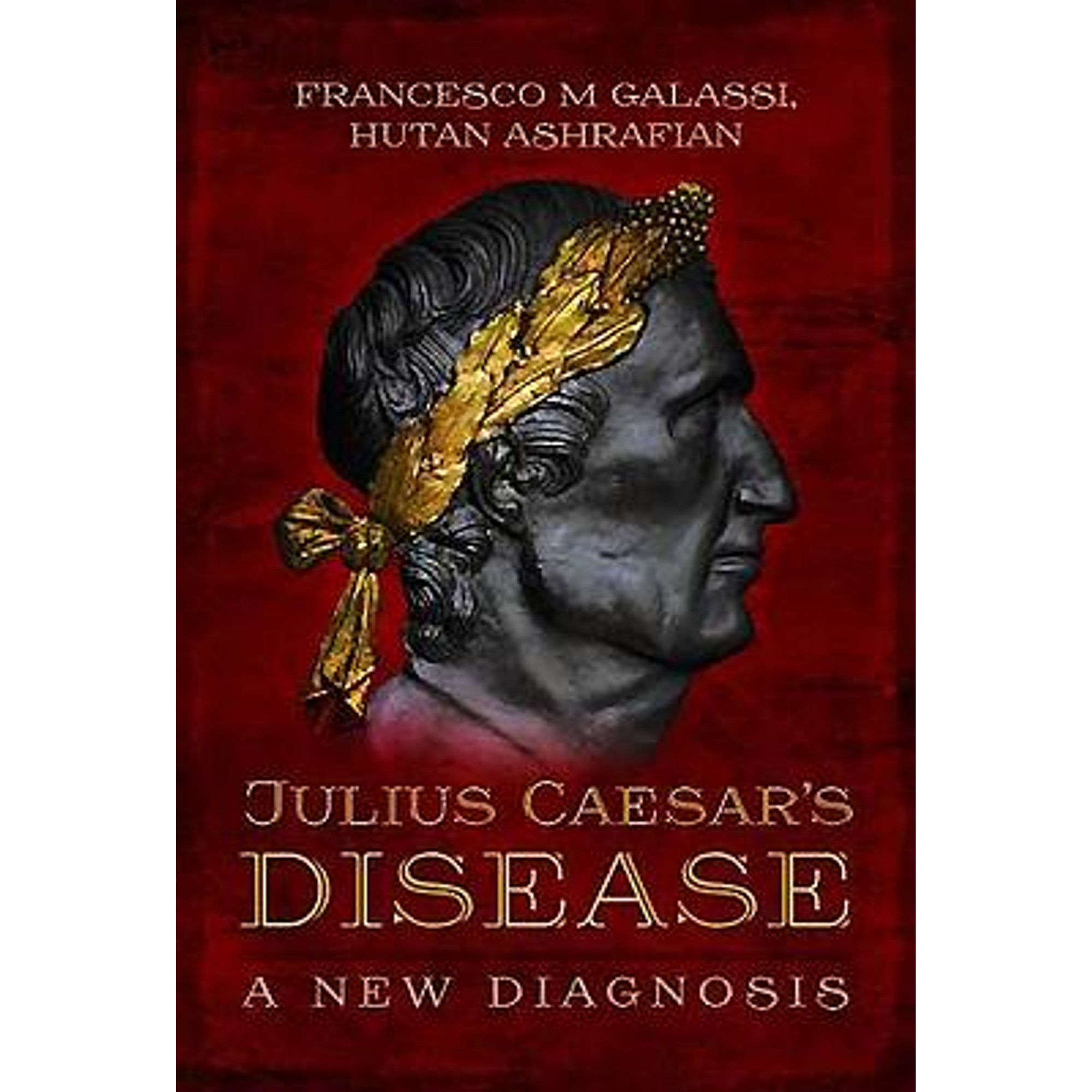 Pre-Owned Julius Caesar's Disease (Hardcover 9781473870789) by Hutan ...