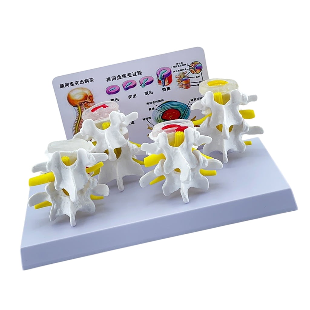 KCAHPAN Human Skeleton Model Human 4 Stages Lumbar Vertebrae Model PVC ...