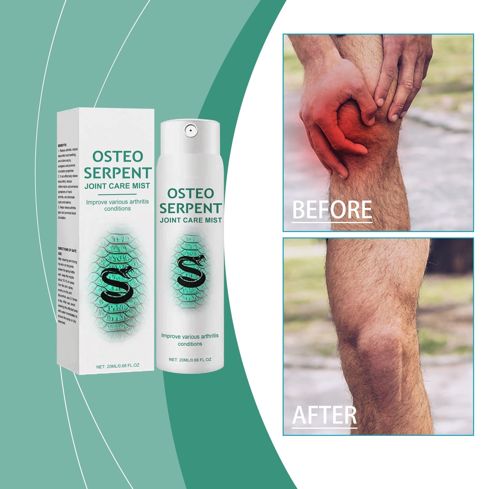 KEGUALV Anti Inflammatory Detumescence Shoulder Swelling Knee Swelling ...