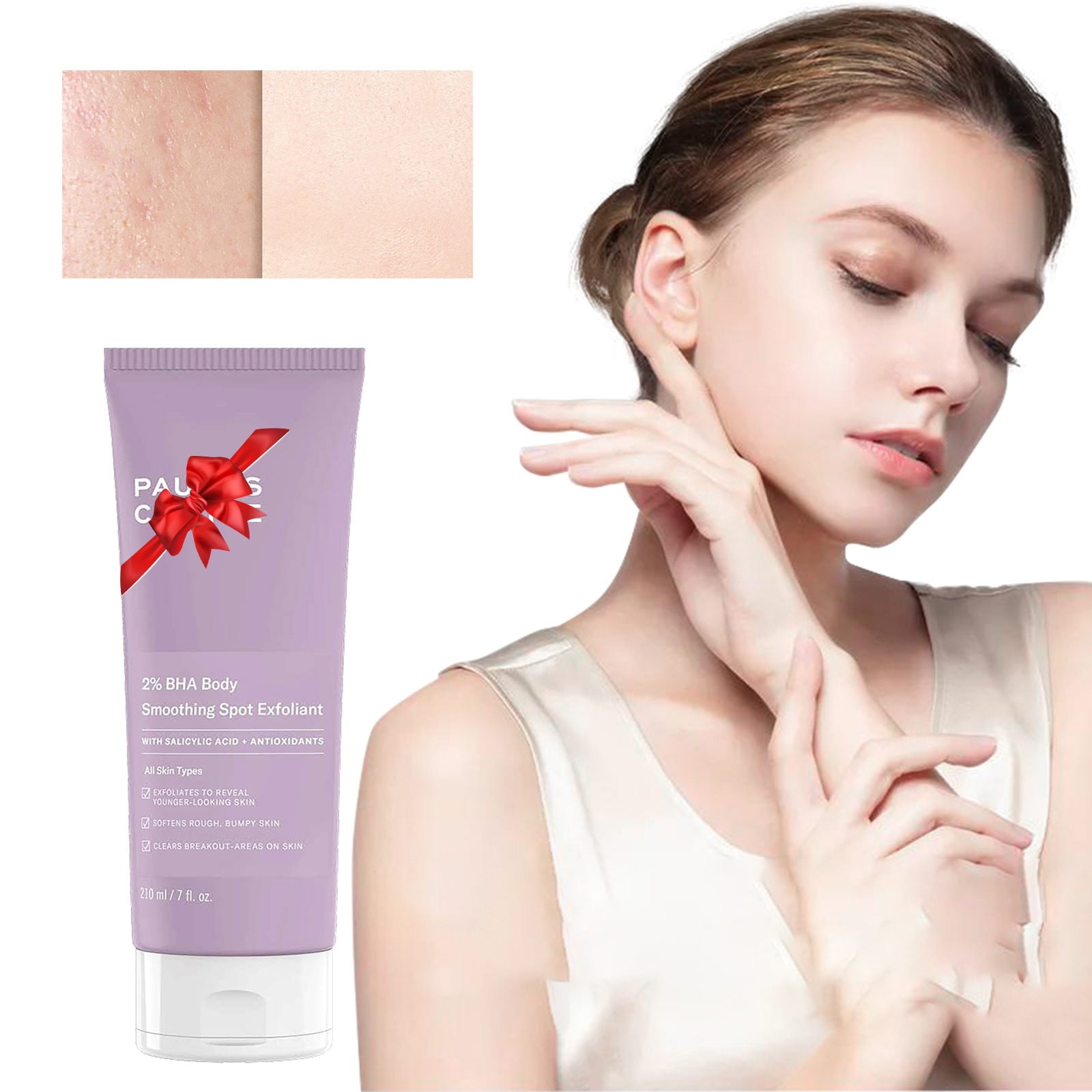 Kegualv Choice Weightless Body 2 Salicylic Exfoliant Moisturizer For