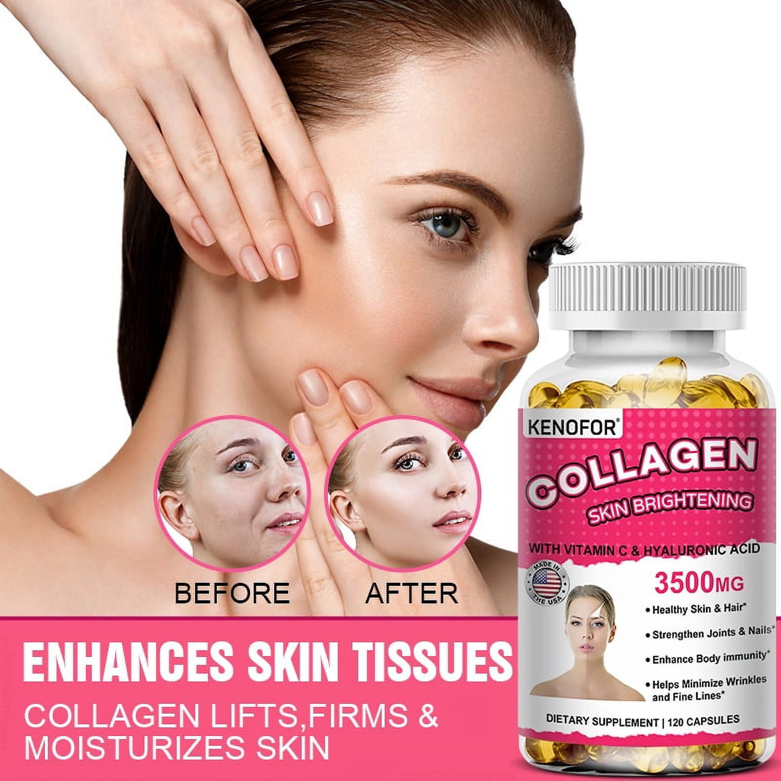 KENOFOR Collagen Softgels - With Vitamin C & Philippines | Ubuy